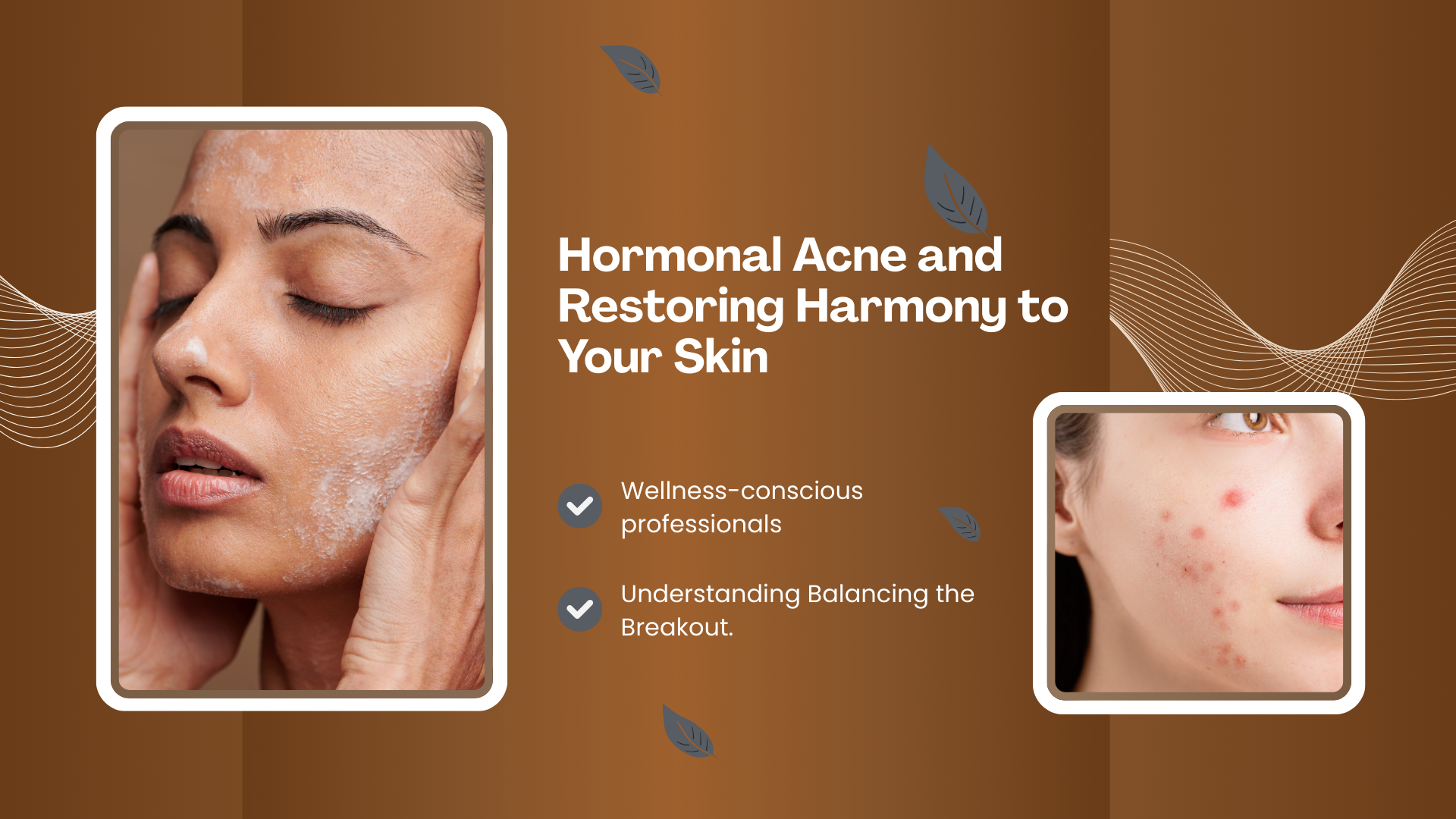 Hormonal Acne and Restoring Harmony to Your Skin - Understanding Balan ...